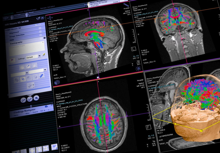 Research | Center for Biomedical and Brain Imaging